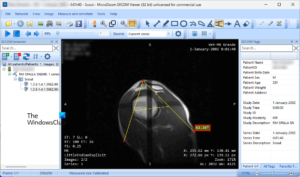 Best free DICOM viewer software for Windows PC