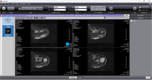Best free DICOM viewer software for Windows PC