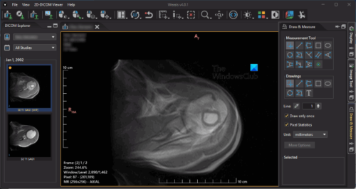 Best free DICOM viewer software for Windows PC