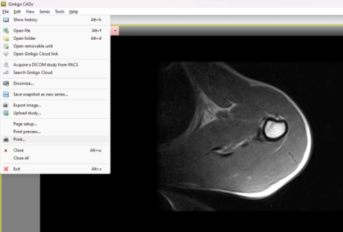 How to convert DICOM to PDF on Windows 11/10